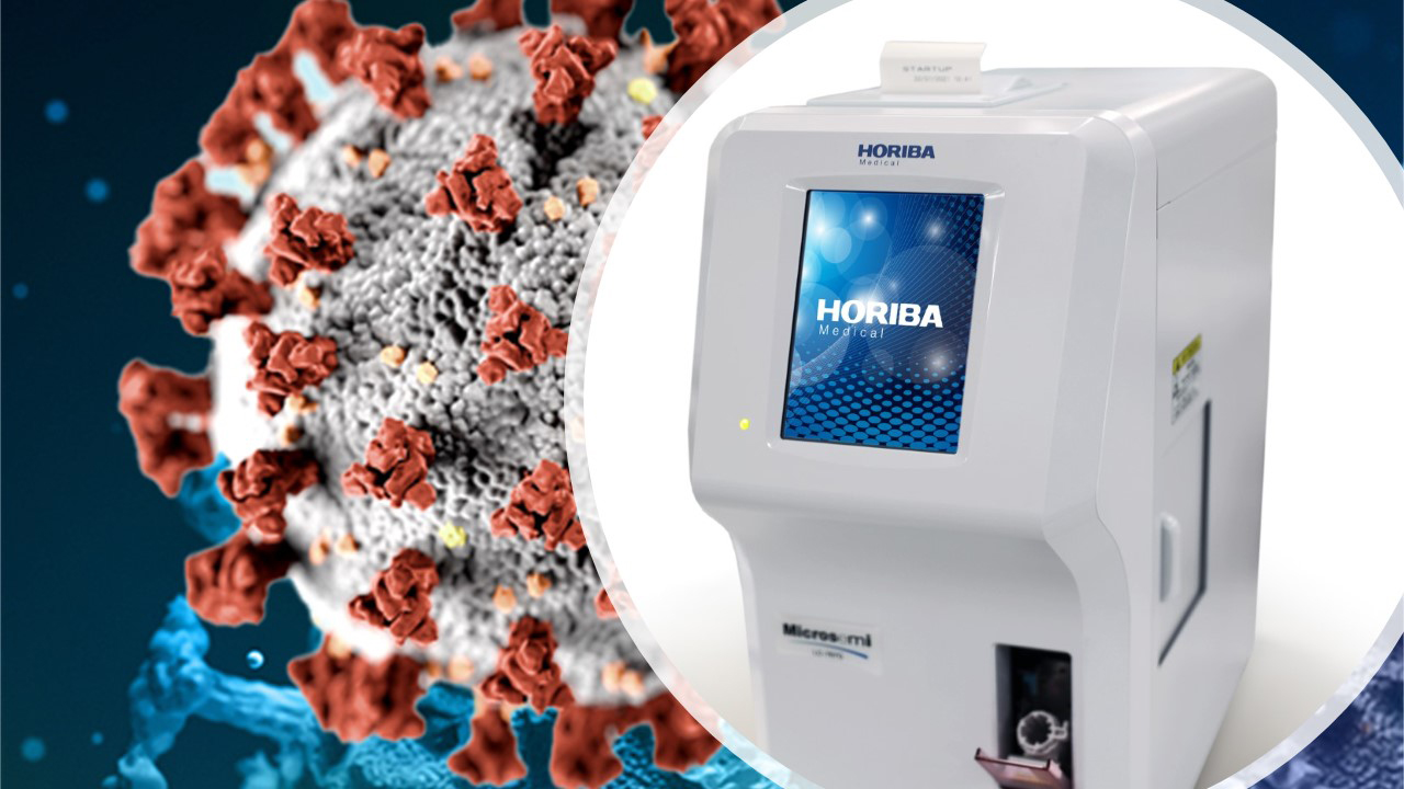 HORIBA Medical receives CE Mark for new generation Microsemi CRP ...