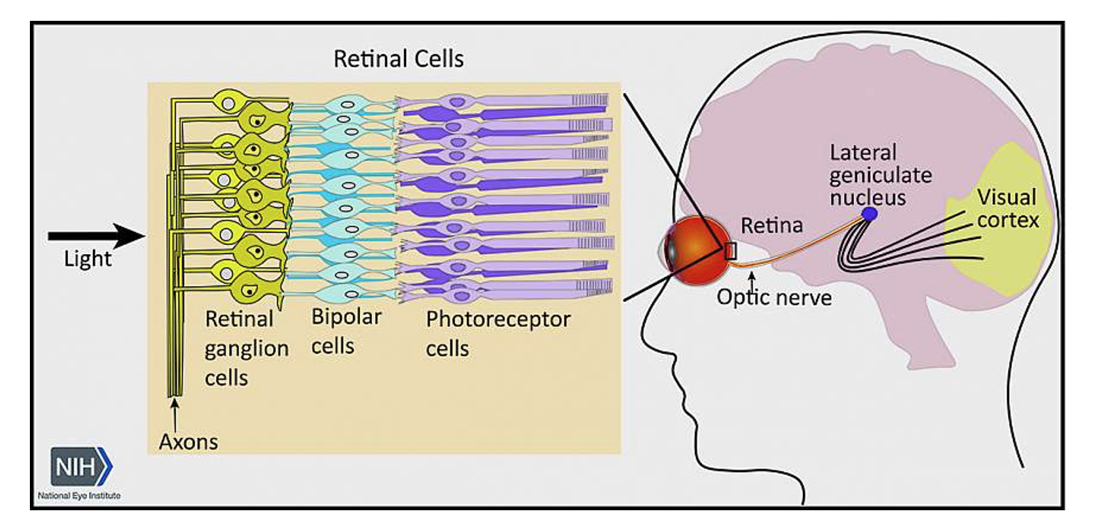 Researchers find gene therapy provides neuroprotection to prevent ...