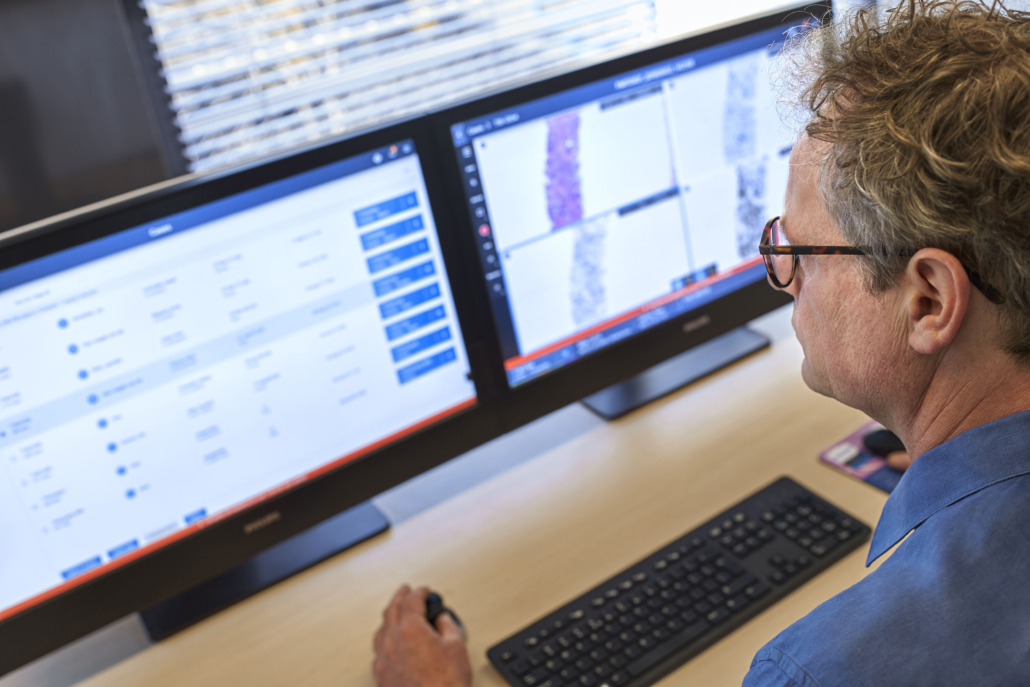 Philips introduces IntelliSite, a next-gen Digital Pathology Suite ...