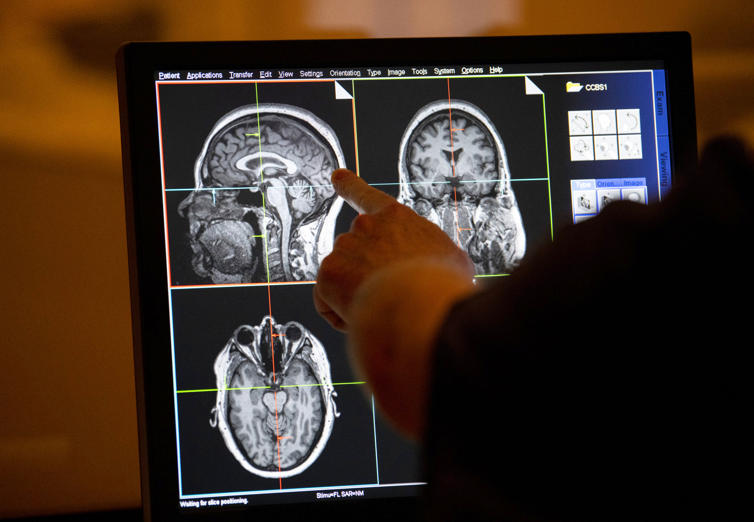 Cleveland Clinic launches first-of-its-kind brain study aimed at ...