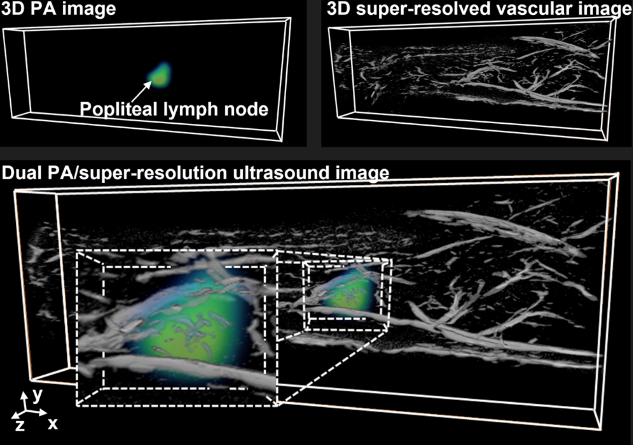 Innovative new dual-modality imaging technique can facilitate earlier ...