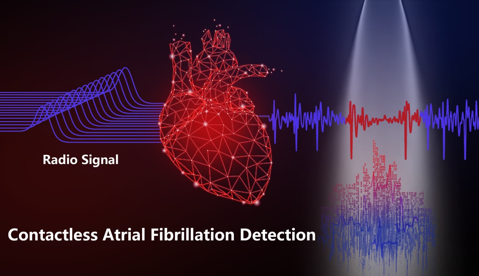 Contactless Atrial Fibrillation Detection System Achieves Clinical Grade Accuracy