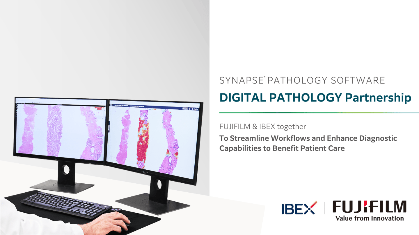 Fujifilm partners with Ibex for AI-powered cancer diagnostics - International Hospital