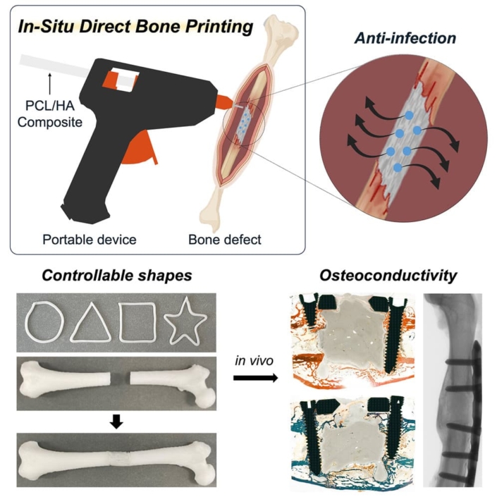 Scientists develop portable bone printer to create custom implants ...