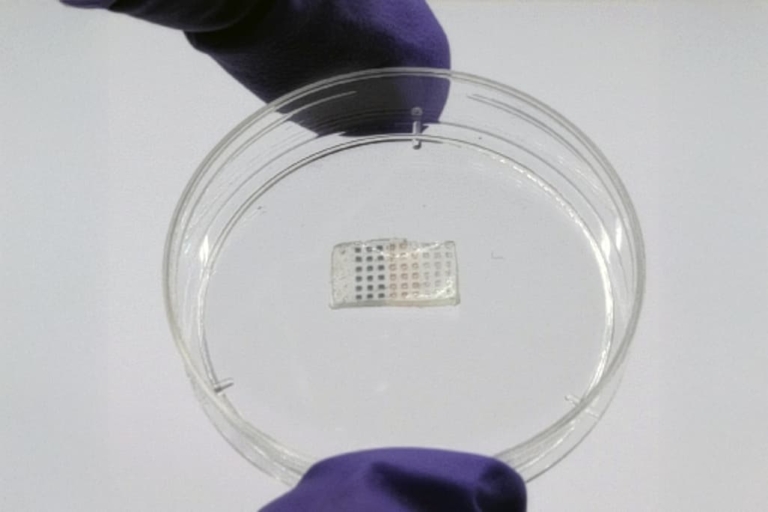 Programmable heart patch cuts cardiac damage by 50% after myocardial ...