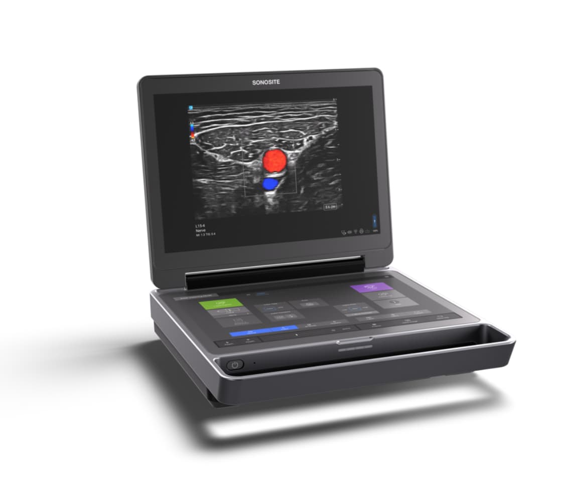 FUJIFILM Sonosite unveils portable MT ultrasound system – International ...